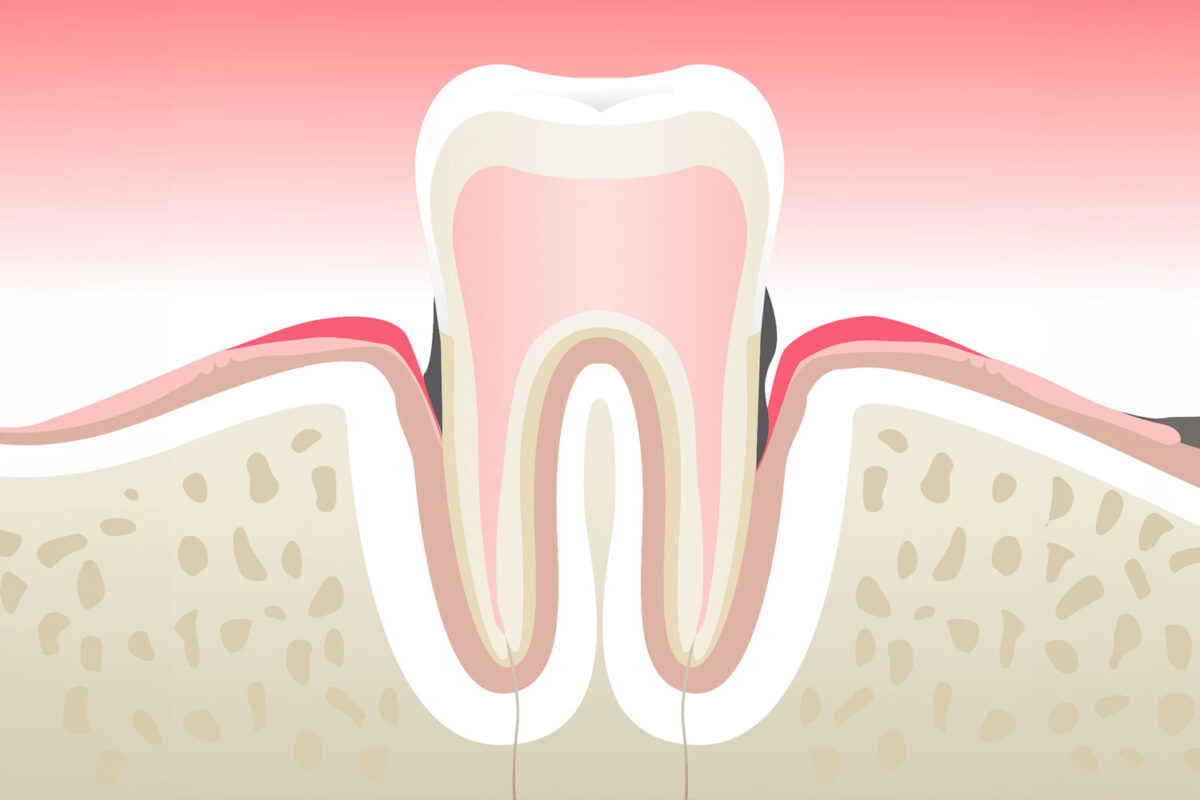 Parodontologie Paris 15 - Cabinet Félix Faure - Parodontiste Paris